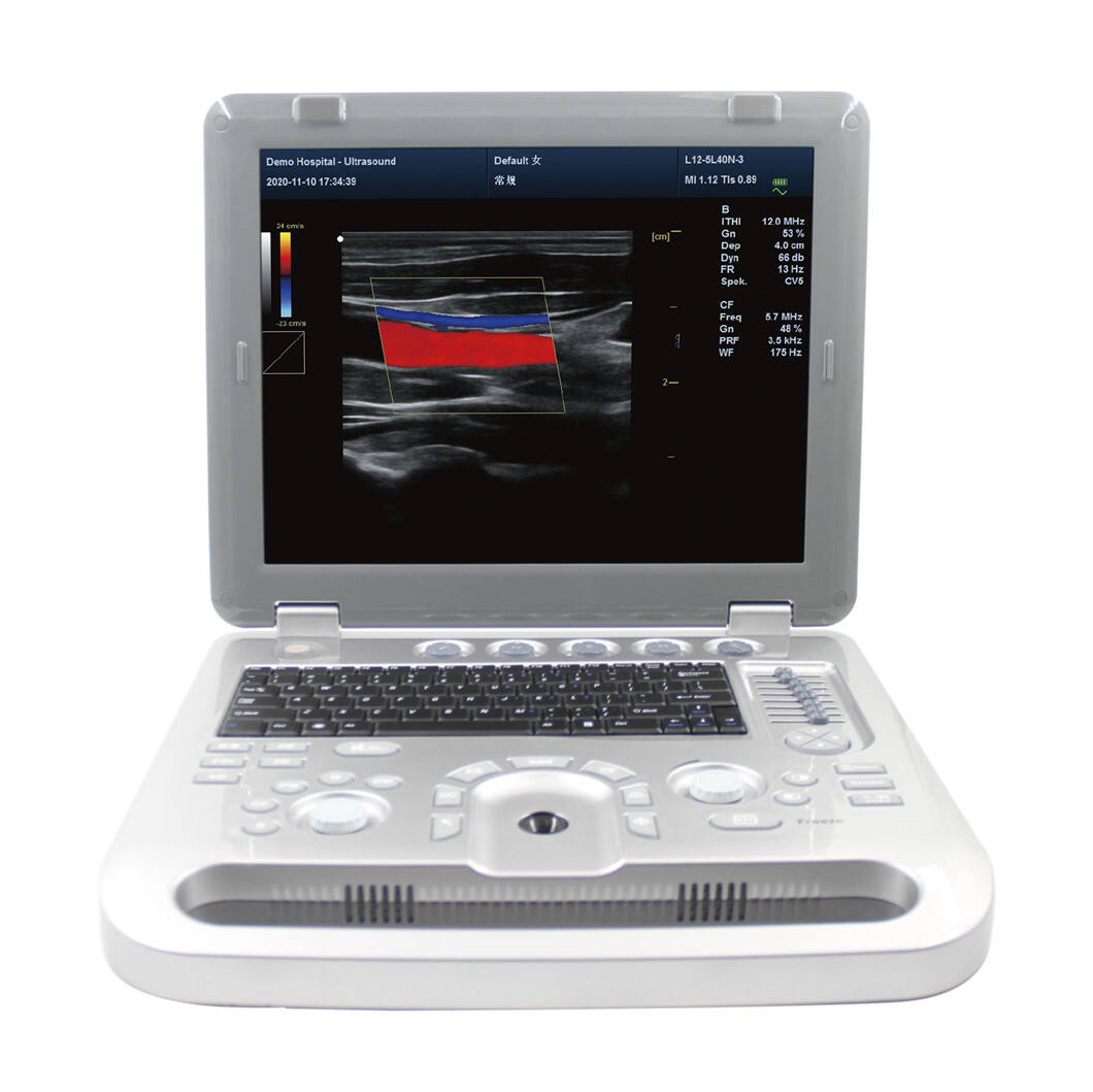 Ultrasound Scanner for Medical Professionals | Healicom