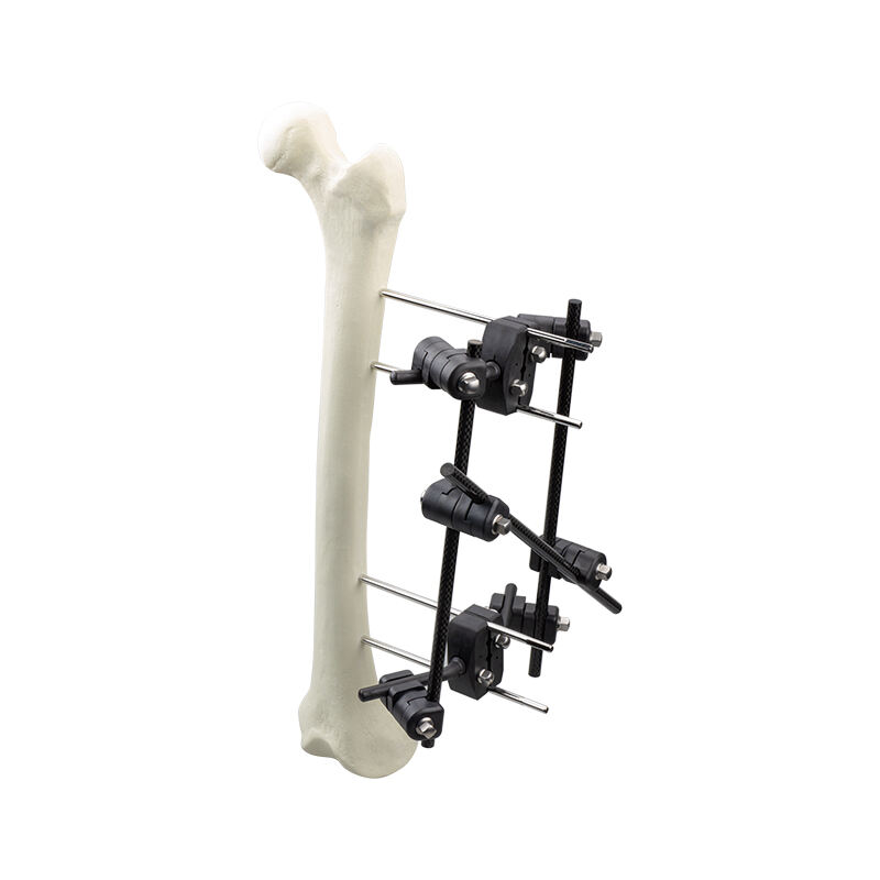 Φ8 0 Series External Fixation Fixator Femoral Unilateral Reinforcement Frame External Fixation